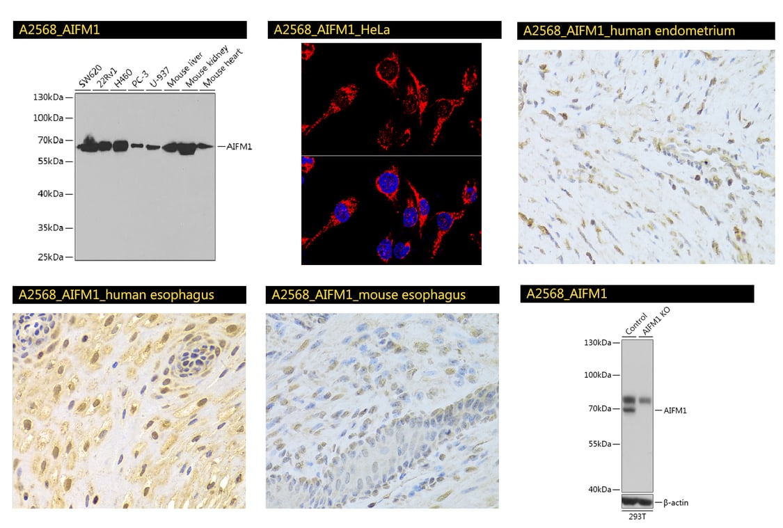 Featured Product Weekly: AIFM1 Antibody