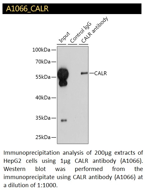 Endoplasmic Reticulum Marker