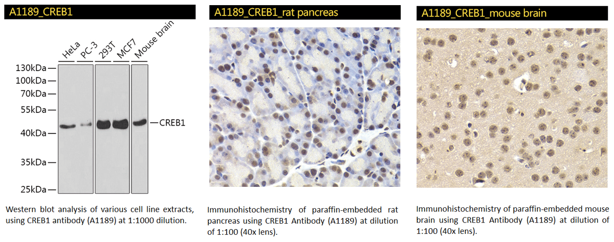 CREB1 Antibody: Featured in Nature Communications