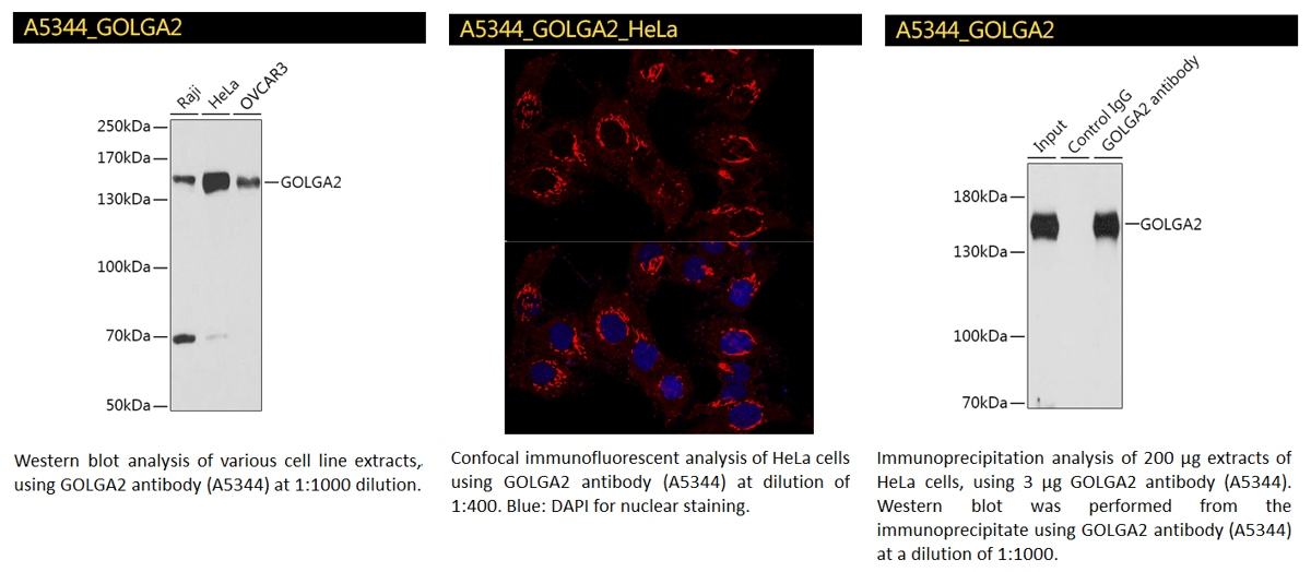 Golgi Apparatus Markers