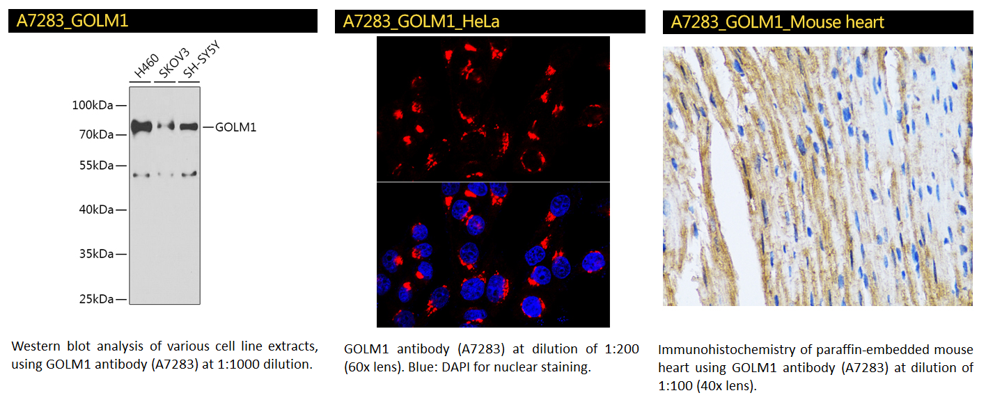 Golgi Apparatus Markers
