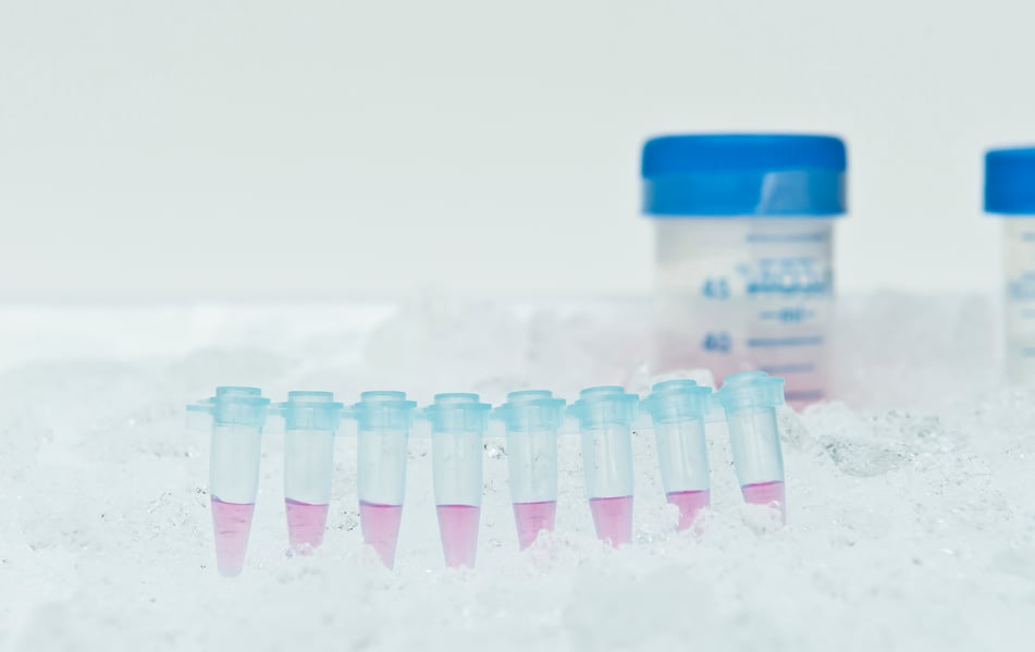 Choosing the Right RNA Lib Prep Kit for Your Transcriptome Library
