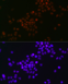 A Thorough Introduction Of Wnt β Catenin Signaling Pathway