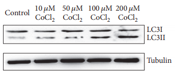5 Notes For Autophagy Detection With LC3