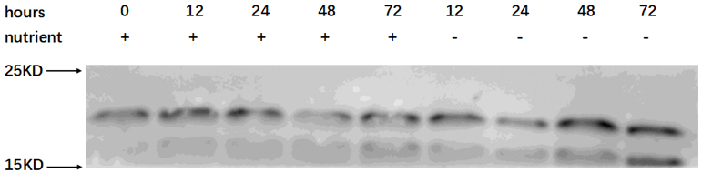 5 Notes For Autophagy Detection With LC3